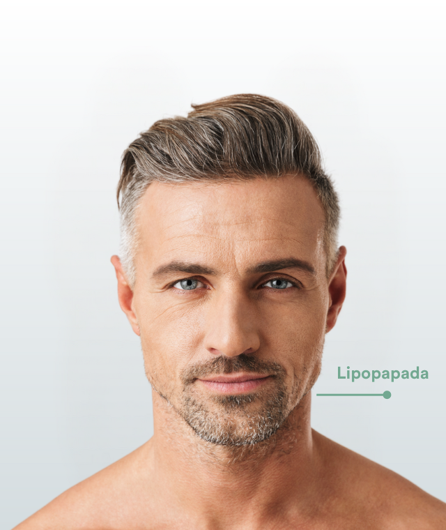 Lipopapada – Aura Laser