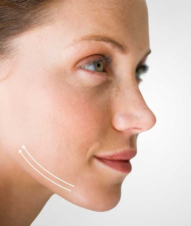Lipopapada sin cirugía – Aura Laser